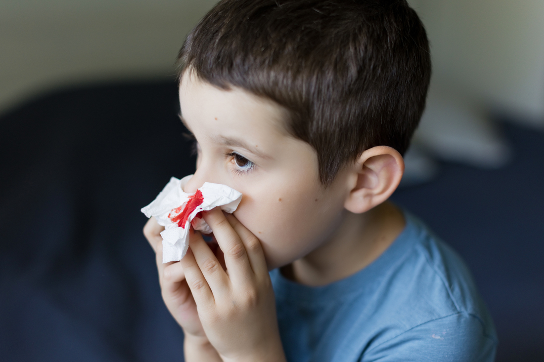 Bloody nose store
