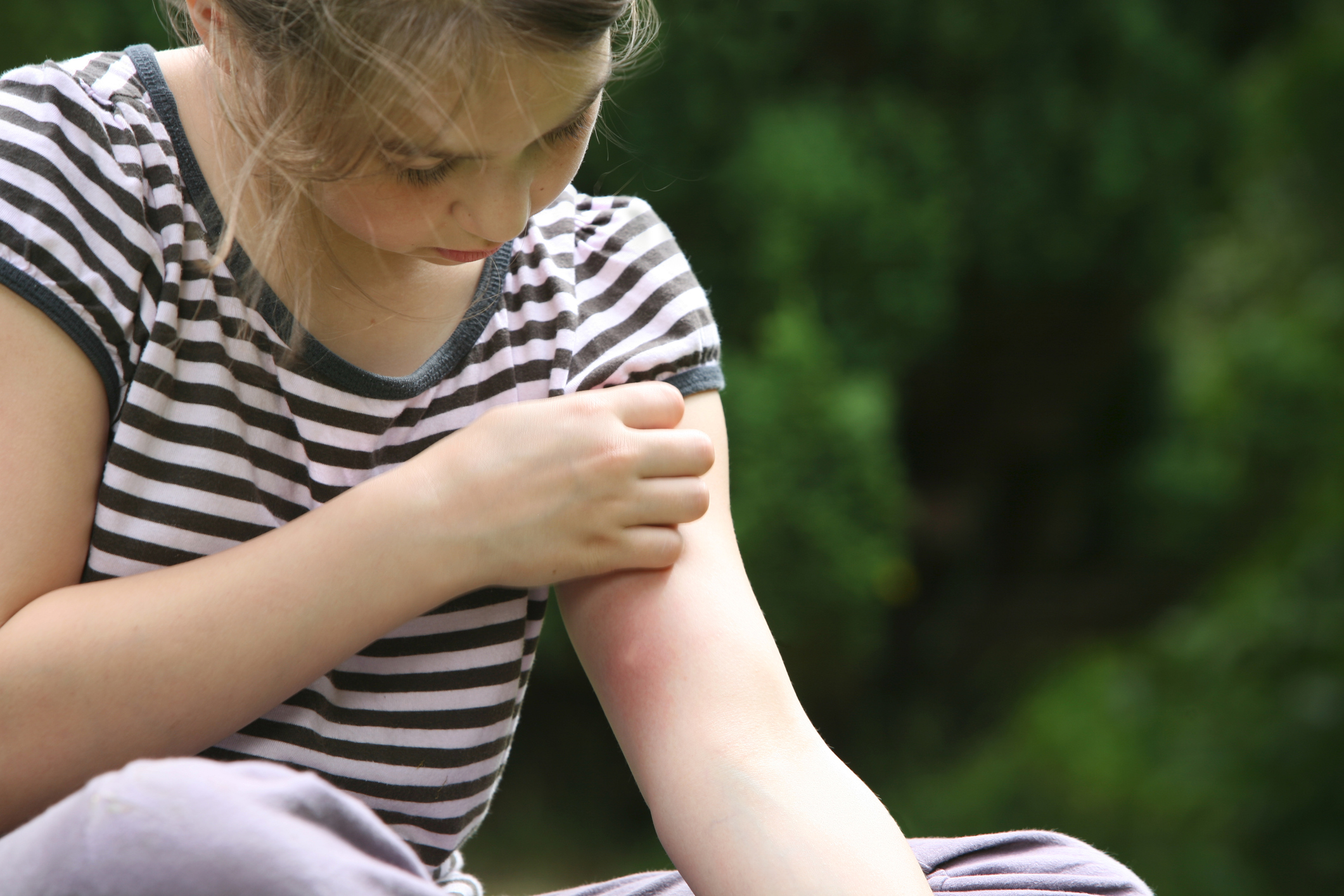 The Best Ways to Avoid a Mosquito Bite & How to Recover Quickly